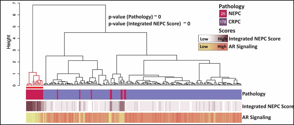 N-MYC in NEPC | Rickman Lab
