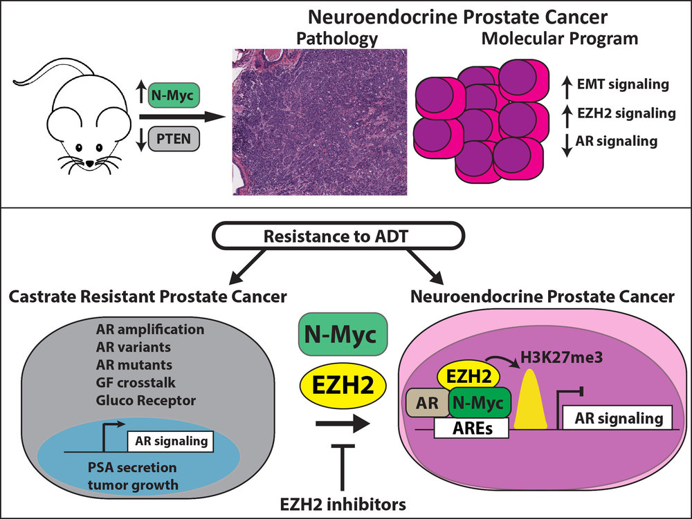 N-MYC in NEPC | Rickman Lab N-MYC in NEPC | Rickman Lab